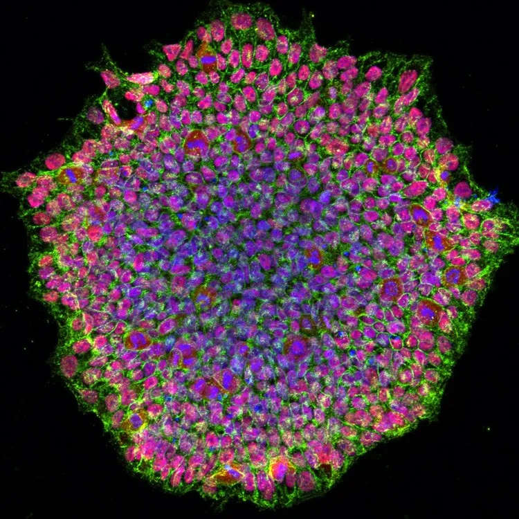 Induced Pluripotent Stem Cells About Stem Cells