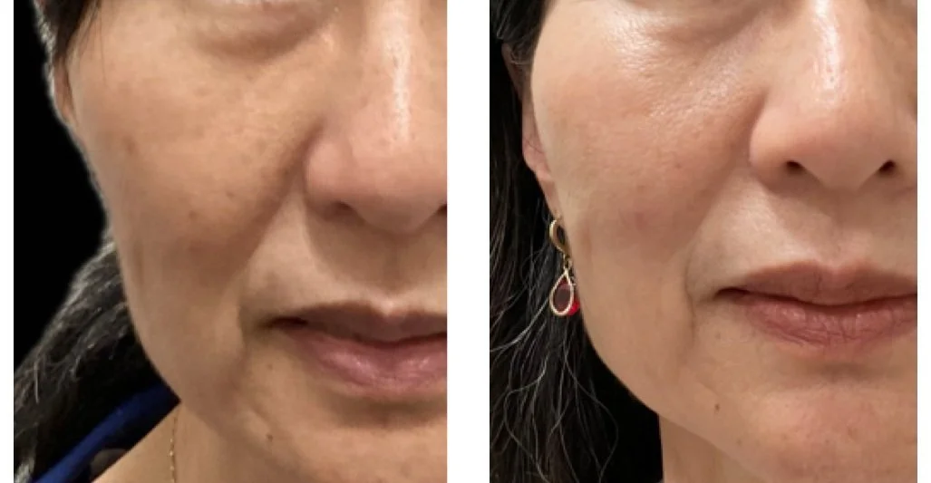 Pretty Medical Spa - San Diego, CA