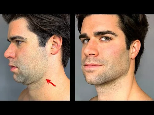 What is mewing and does it work?