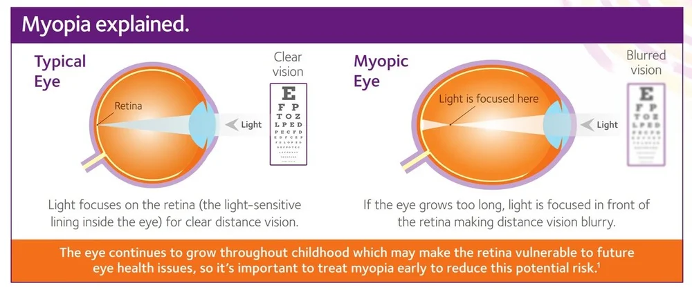 General 3 — Mile High Eye Care