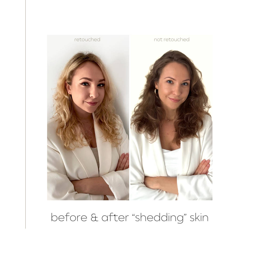 Shedding Skin — Katarzyna Rudzka