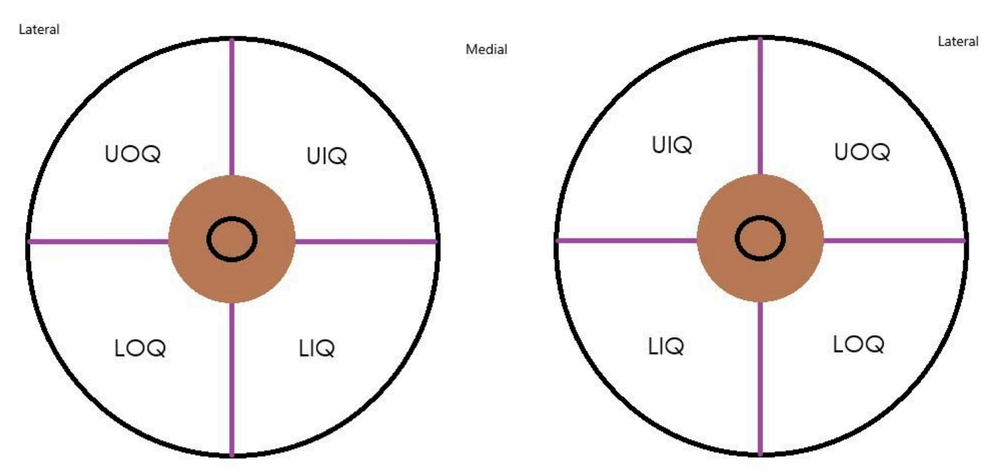 Quadrants | Enhance Imaging Precision Today — MammoMind