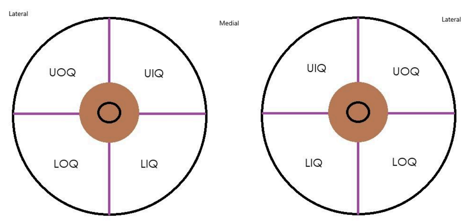 Quadrants | Enhance Imaging Precision Today — MammoMind