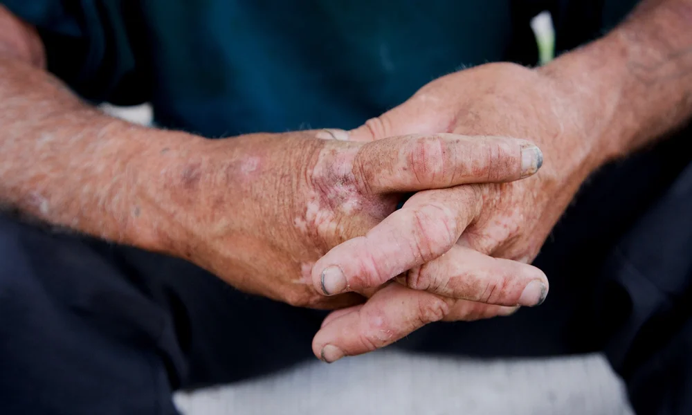 Care Locations — Healthcare for the Homeless - Houston