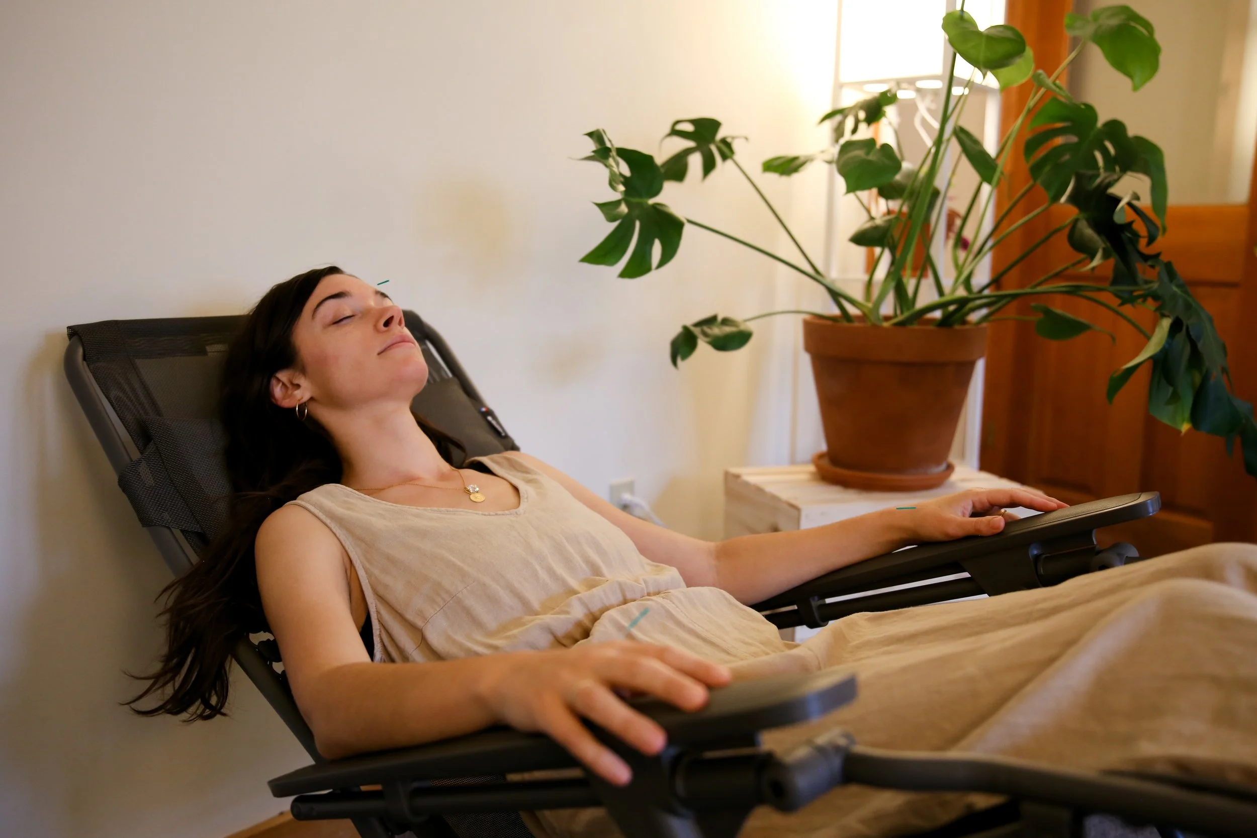 The Acupuncture Studio VT | Women's Health, Microneedling, and Cosmetic ...