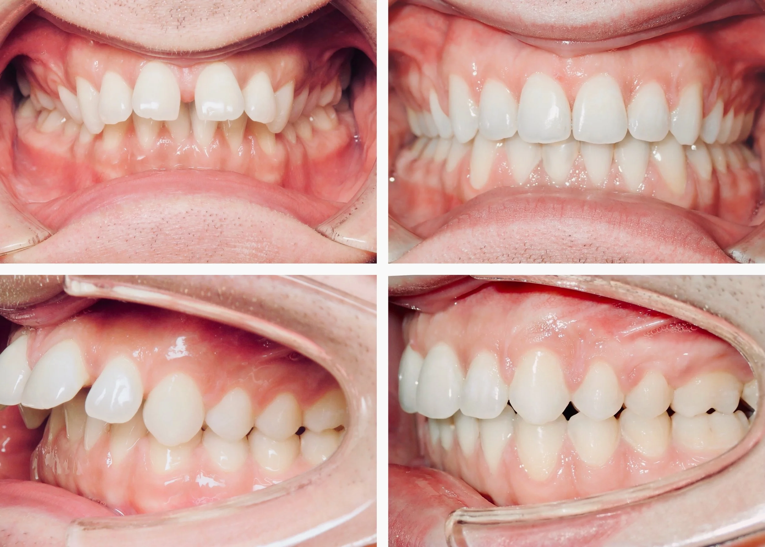 Fabulous Finish | Amley McEntire Orthodontics