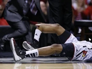 Kevin Ware Compound Tibia Fracture — Mending Playbook