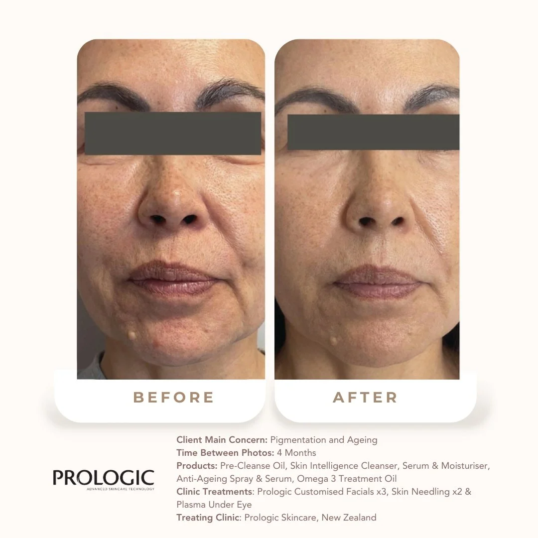 Prologic Skincare