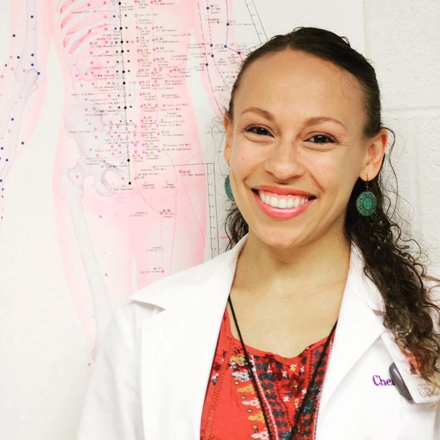 Acupuncture — 690WomensFitness
