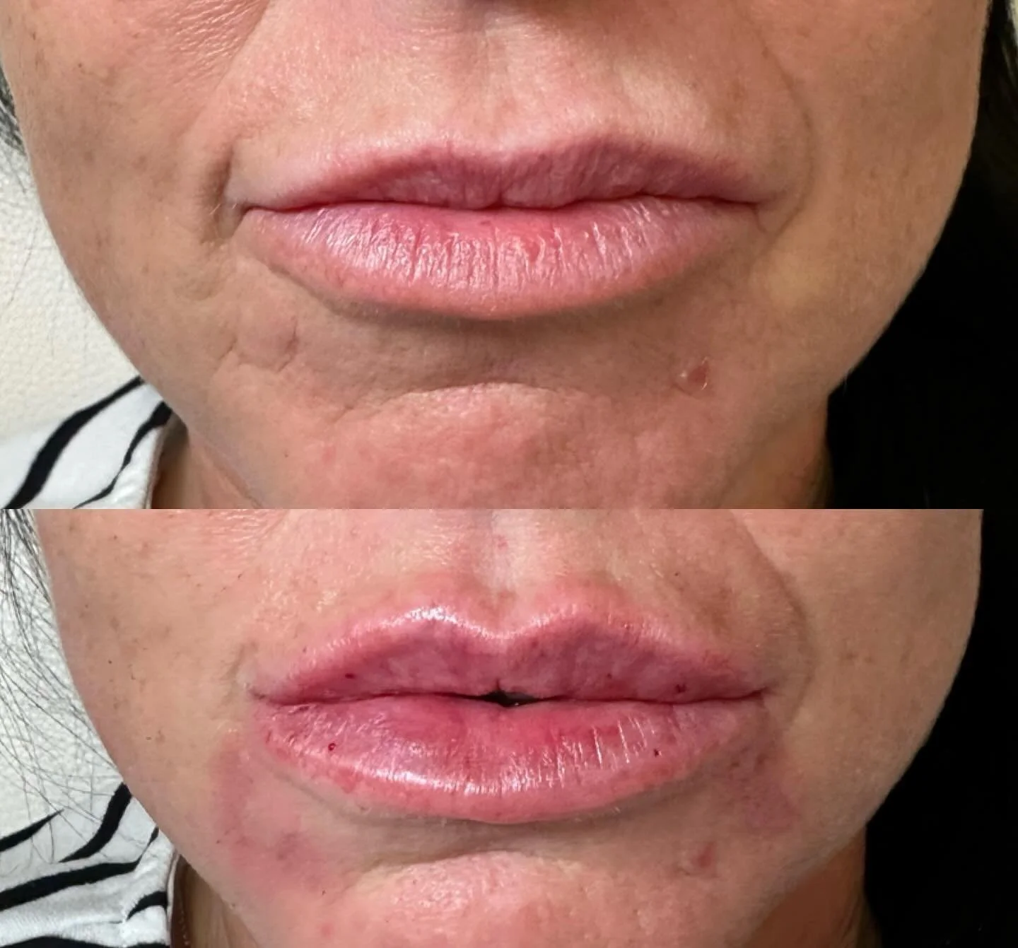 Inhance cosmetic clinic