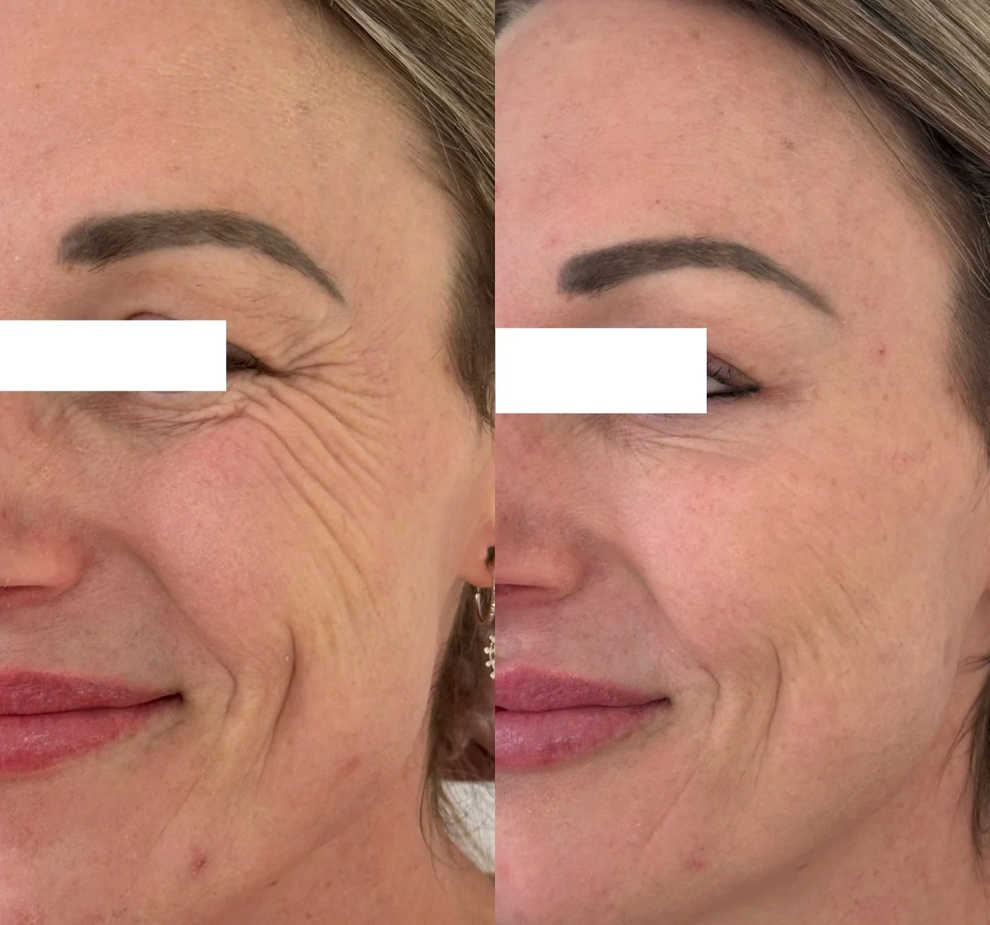 Inhance cosmetic clinic