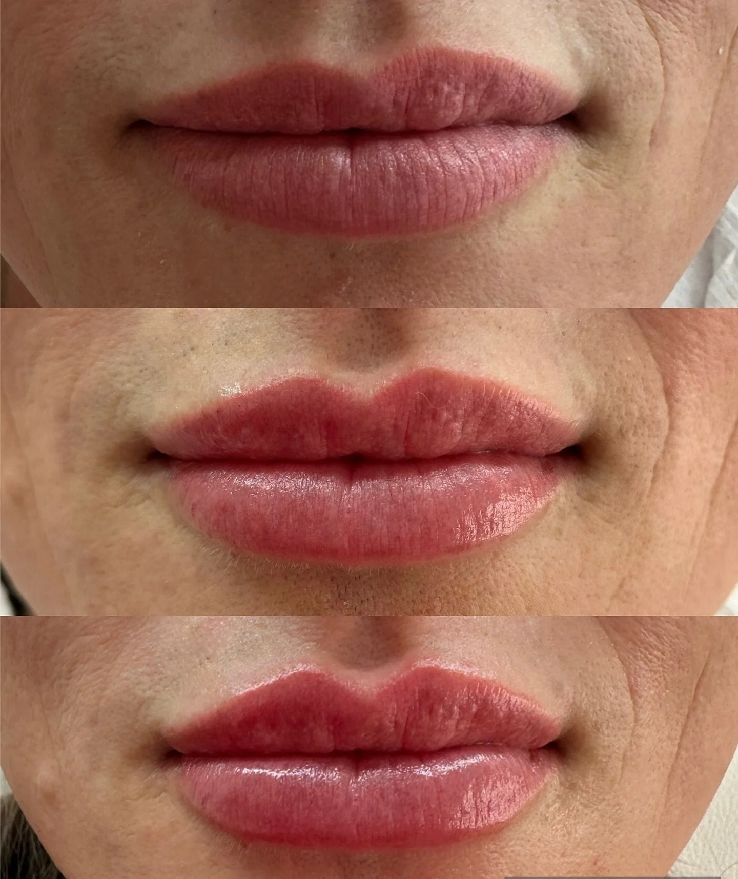 Inhance cosmetic clinic