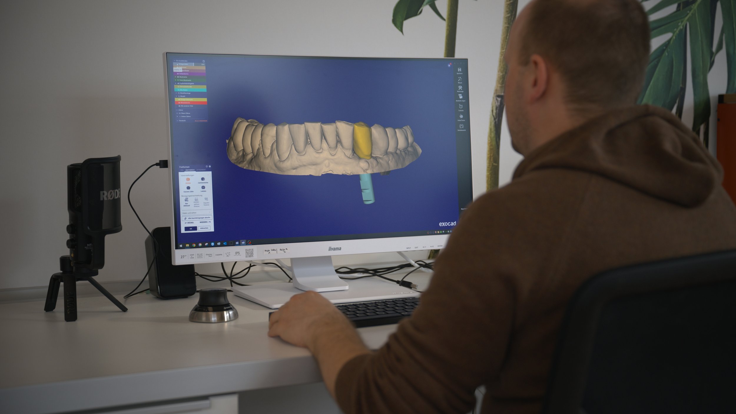 digital dental lab | dentesthetics