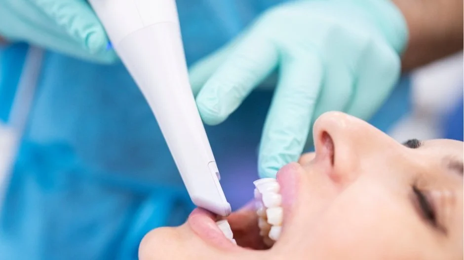 Say Goodbye to Gooey Impressions: Digital Scanners vs. Traditional ...