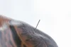 How Often Can You Do Dry Needling for Optimal Results?