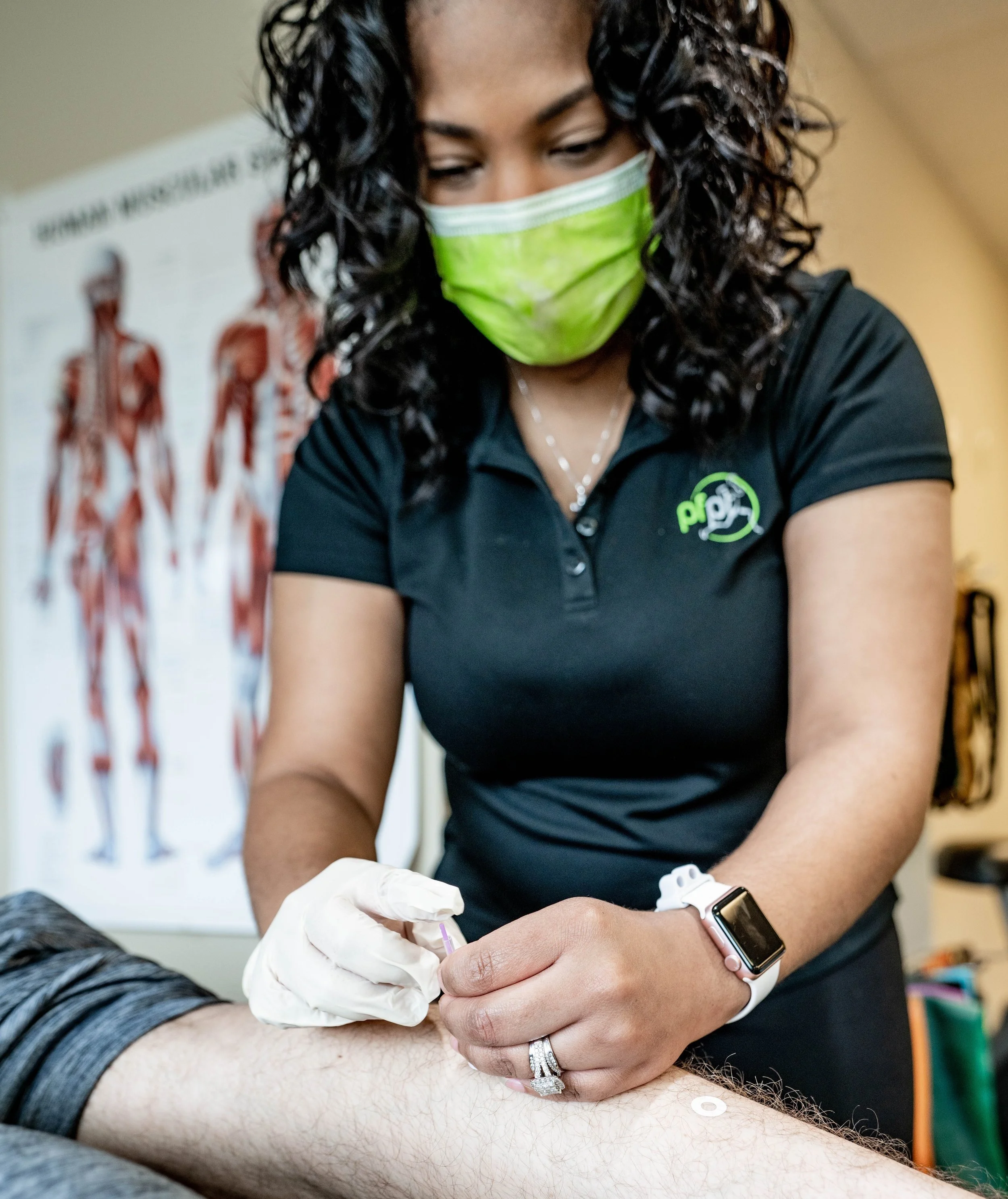 What Does Dry Needling Do? Discover Its Healing Power