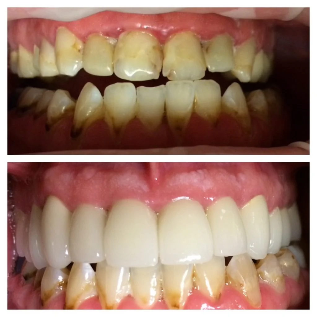 Smile Gallery — Woolf Dental