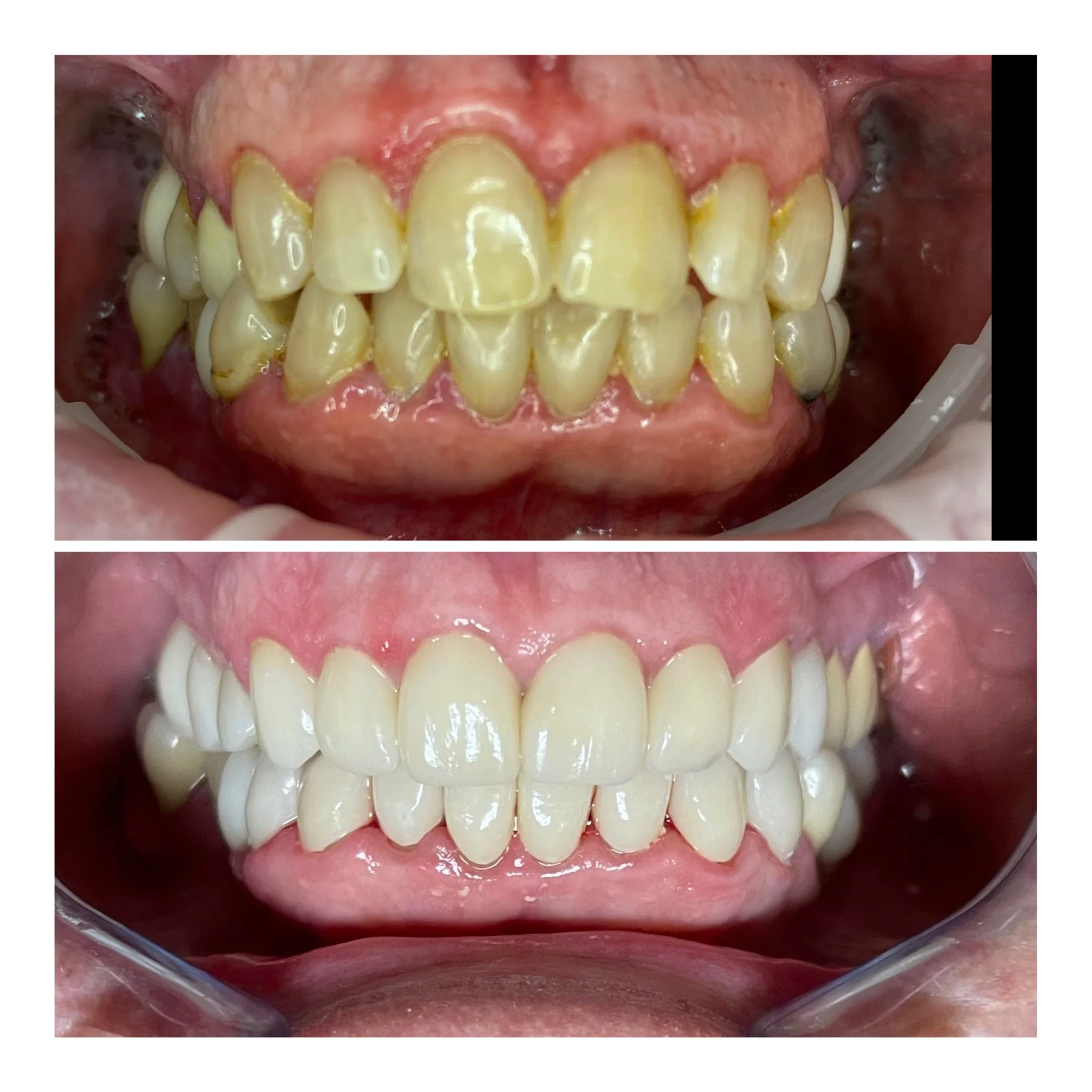 Smile Gallery — Woolf Dental