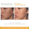 VAMP Facial Salmon DNA Microneedling Treatment | Discover Youthful Skin ...