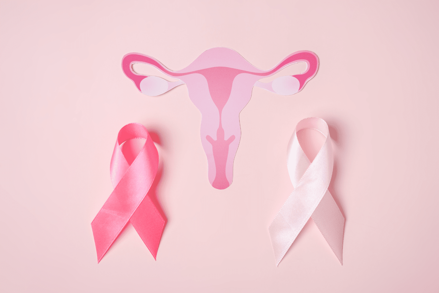 Understanding PCOS Beyond Hormonal Imbalances — The Wellness Way- Sarasota