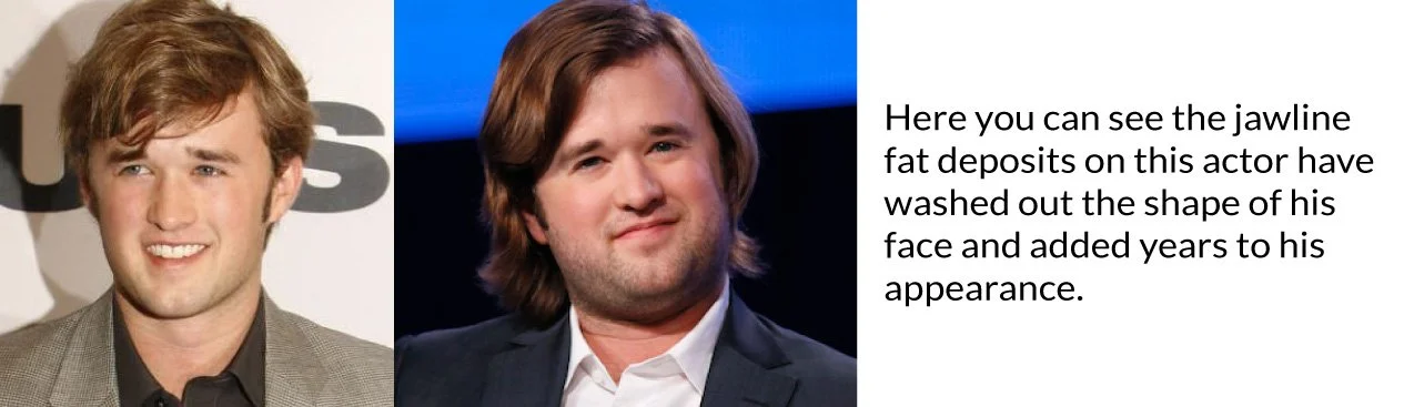 Facing Face-Fat Facts — Kenzai