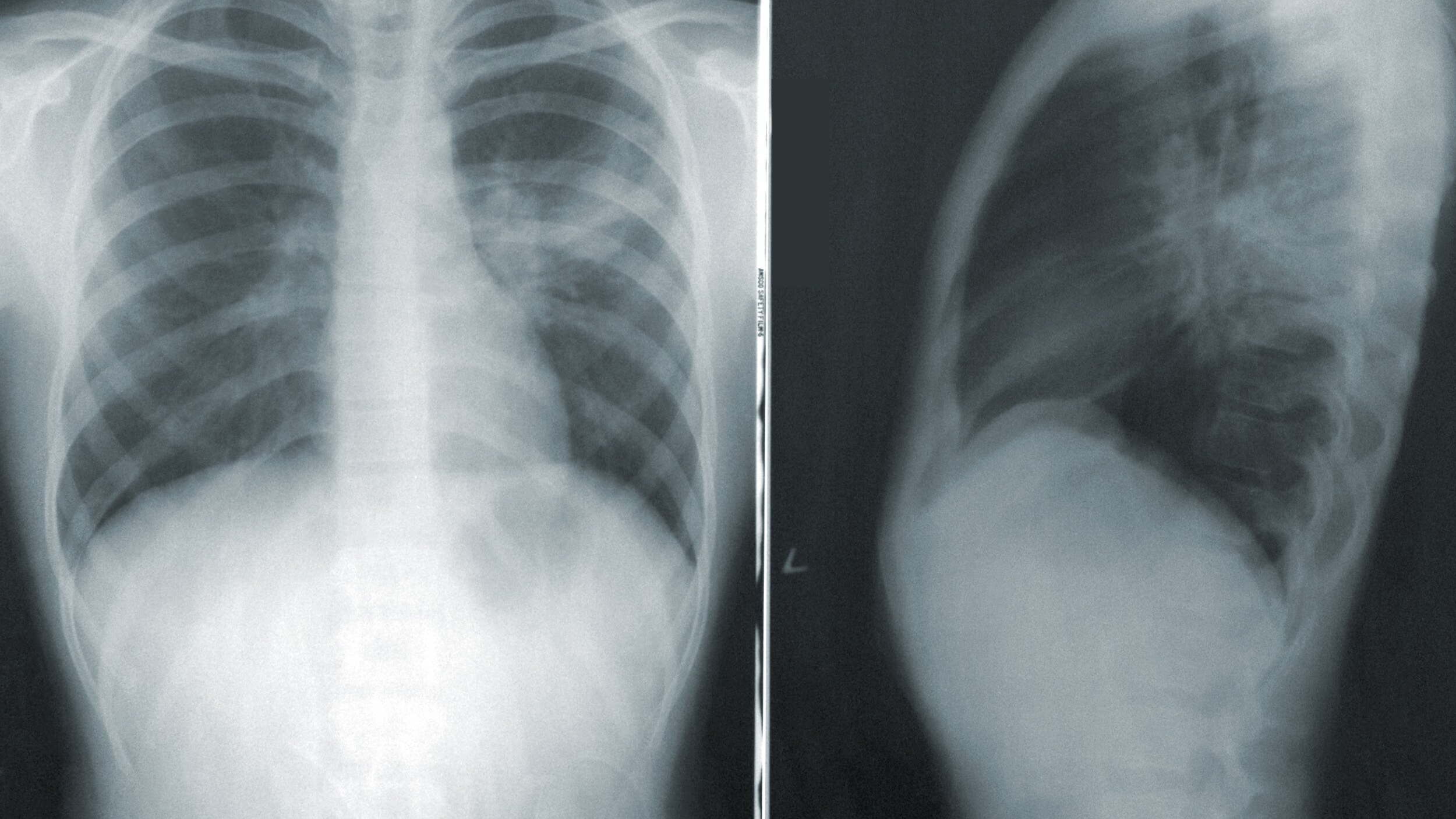 Diagnostic Radiology — Advanced Imaging Services