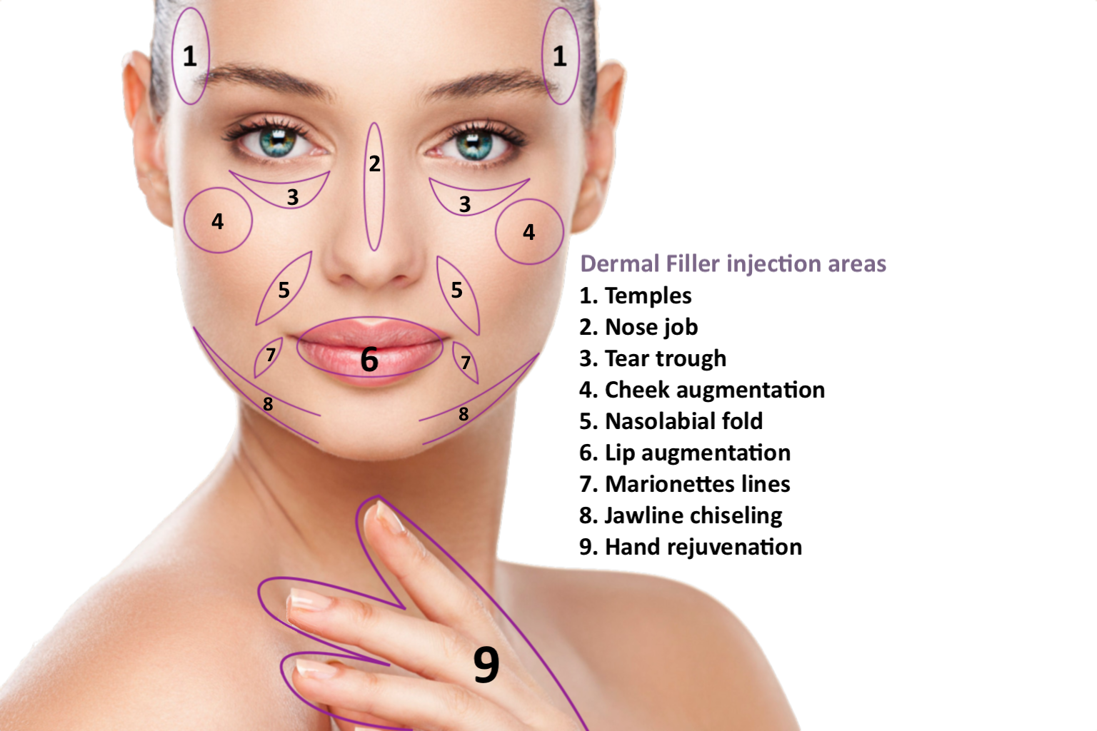 Applications and Benefits of Dermal Fillers — Bonne Vie Medical