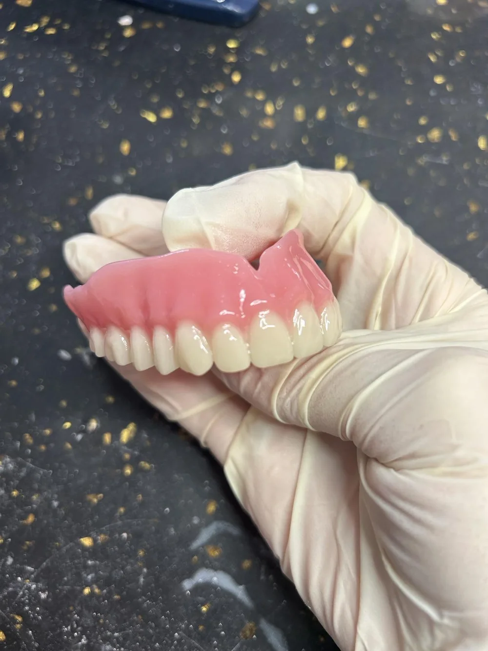Digital Dentures — Hoppers Health Denture Clinic