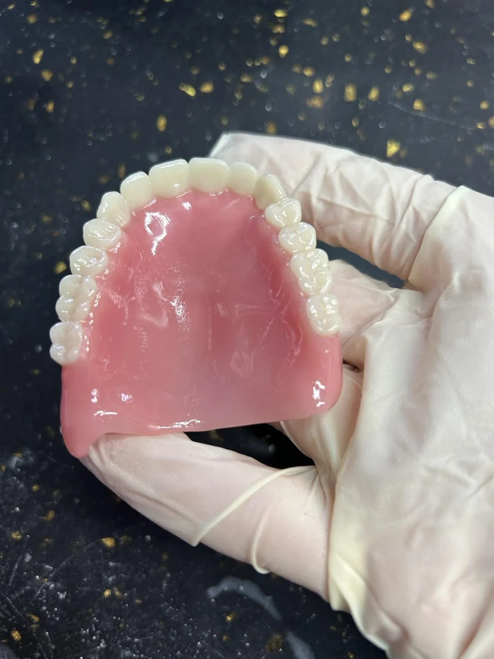 Digital Dentures — Hoppers Health Denture Clinic