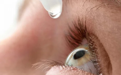 Zaditen eye drop alternatives — DR BRENDAN CRONIN OPHTHALMOLOGIST