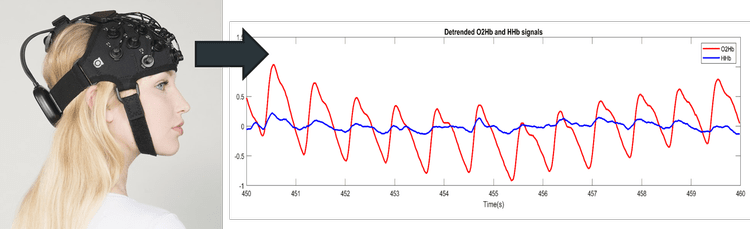 Assessing NIRS signal quality – Implementation of the Signal Quality ...