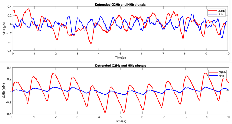 Assessing NIRS signal quality – Implementation of the Signal Quality ...
