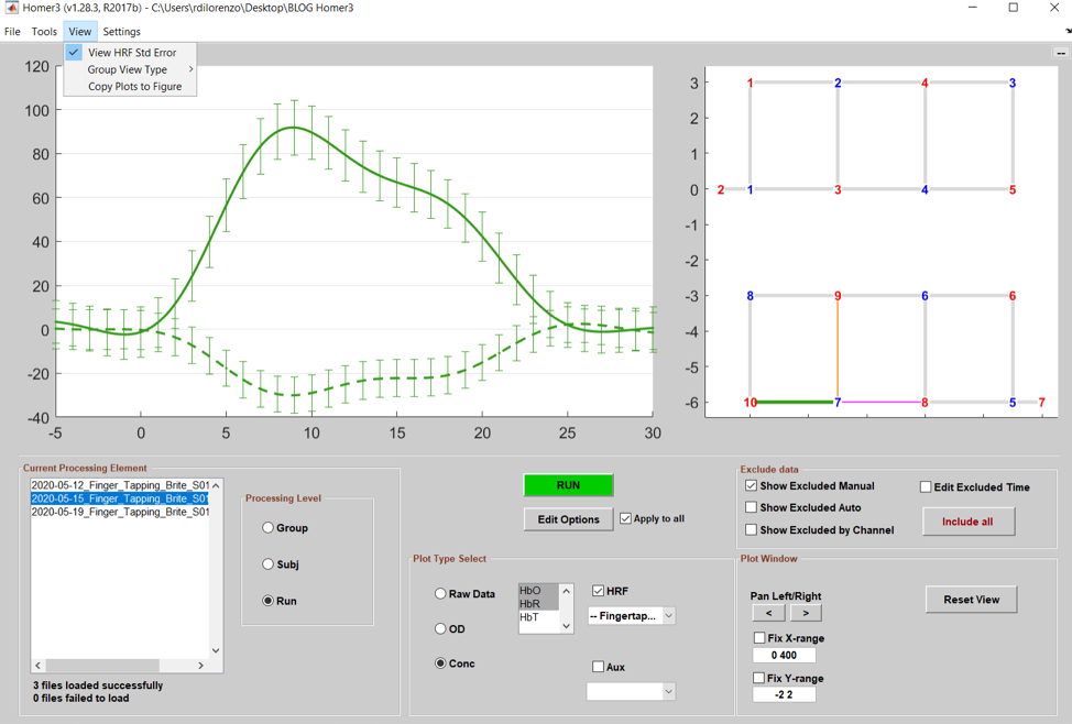 fNIRS analysis toolbox series – Homer — Artinis Medical Systems | (f)NIRS devices