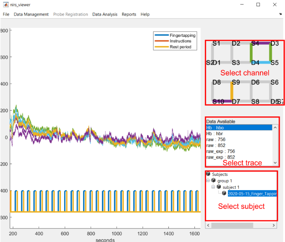 fNIRS analysis toolbox series – Brain AnalyzIR — Artinis Medical ...