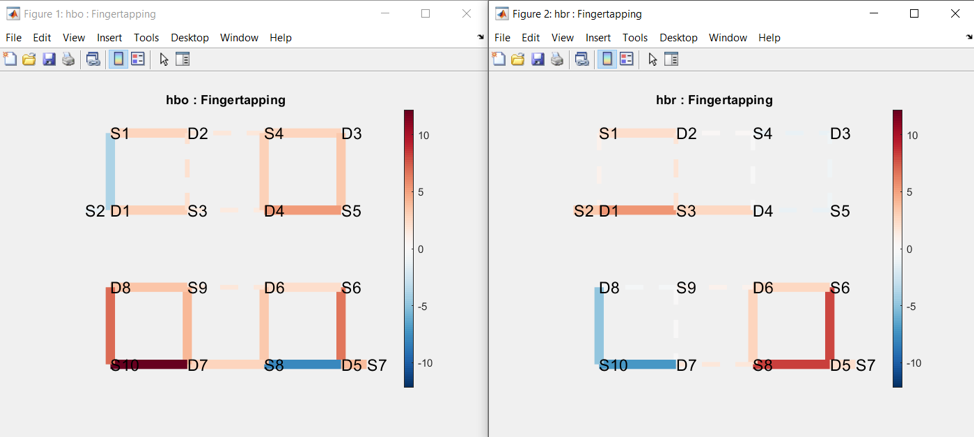 fNIRS analysis toolbox series – Brain AnalyzIR — Artinis Medical ...
