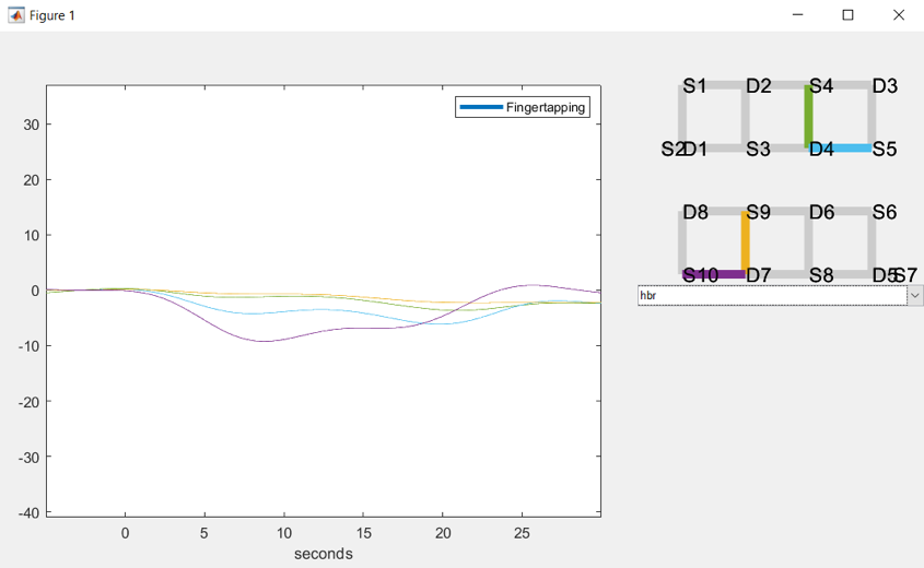 fNIRS analysis toolbox series – Brain AnalyzIR — Artinis Medical ...