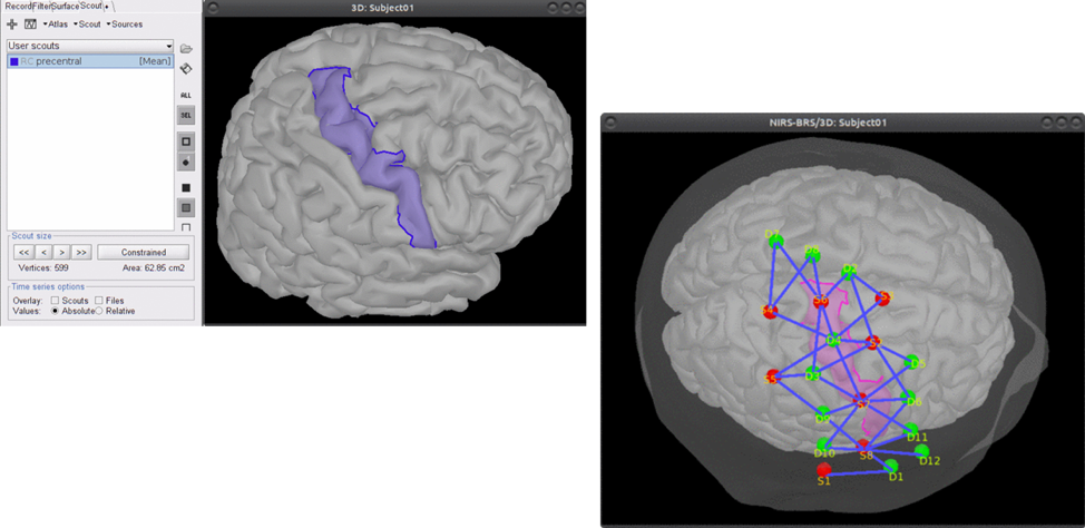 fNIRS analysis toolbox series – NIRSTORM — Artinis Medical Systems | (f ...