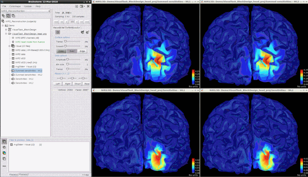 fNIRS analysis toolbox series – NIRSTORM — Artinis Medical Systems | (f ...
