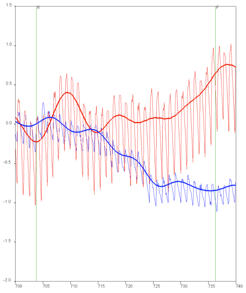 fNIRS analysis toolbox series – OxySoft — Artinis Medical Systems | (f ...