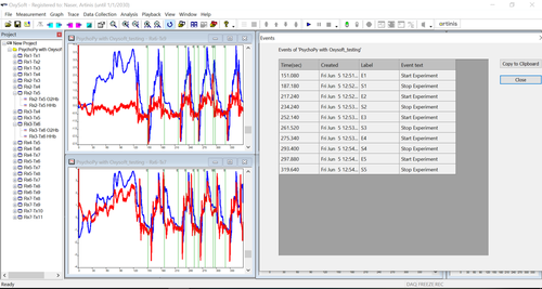 The importance of being precise: using PsychoPy for stimulus ...