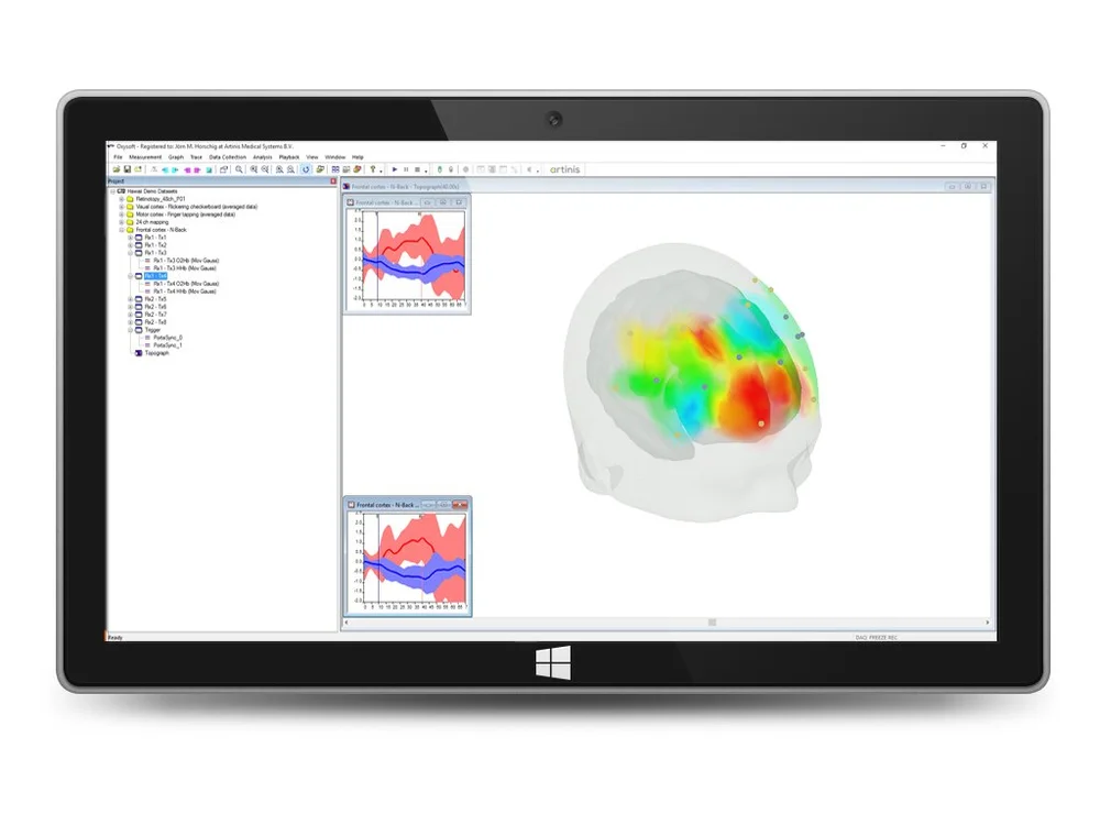 Brite Frontal - Wearable & flexible prefrontal fNIRS device — Artinis ...