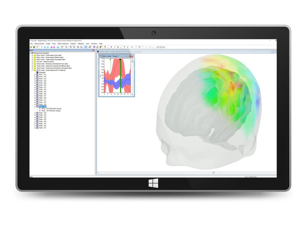 OxySoft — Artinis Medical Systems | (f)NIRS devices