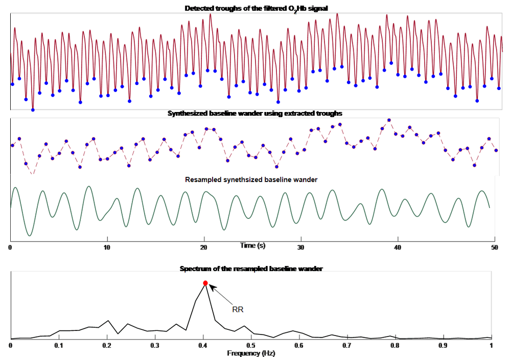 Non-cerebral physiological interference in functional Near-Infrared ...