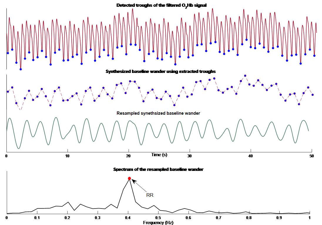 Non-cerebral physiological interference in functional Near-Infrared ...