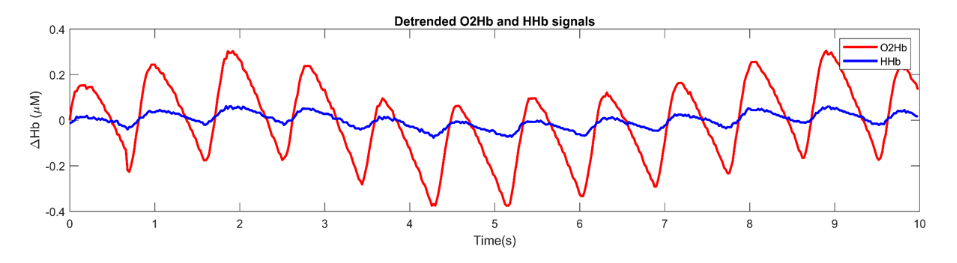 Ensuring good fNIRS data quality — Automatic assessment of signal ...