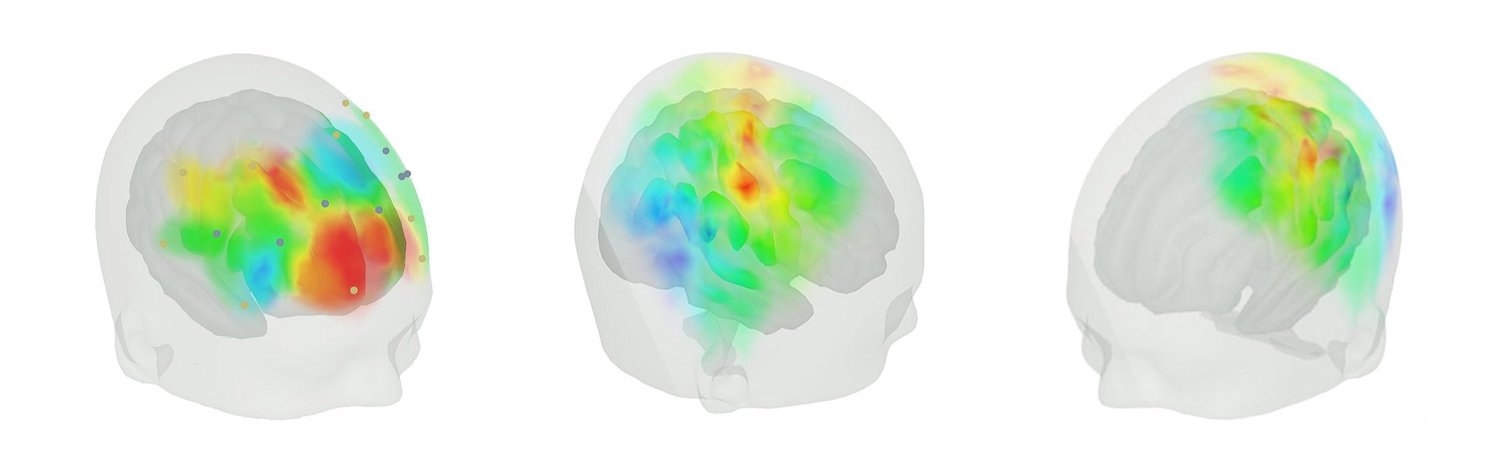 Brite Ultra: fNIRS hyperscanning system — Artinis Medical Systems | (f ...