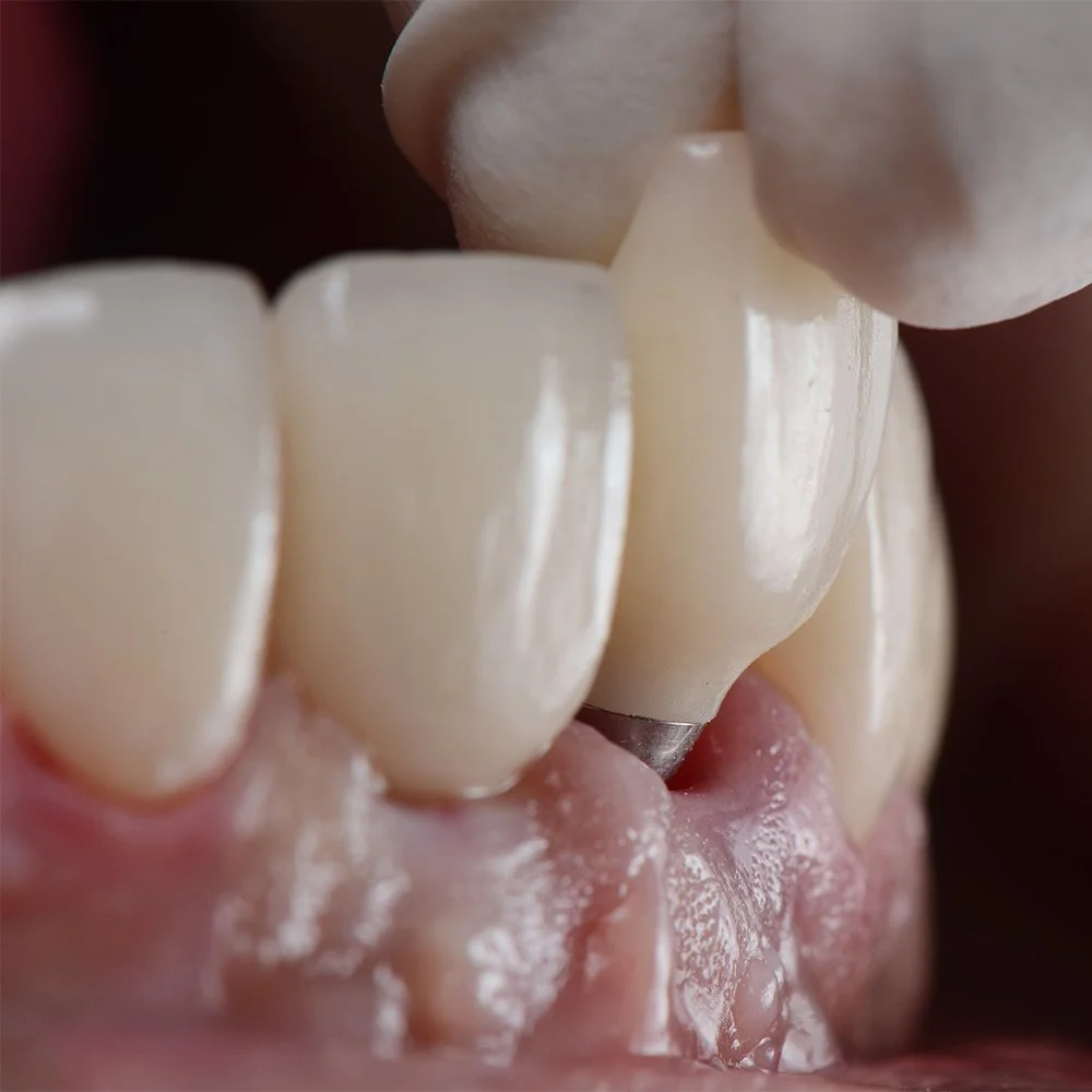 For patients — Perio Specialist Studio