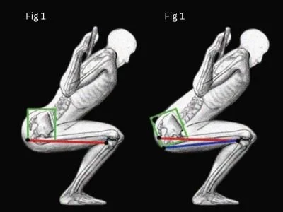 Expert Advice for Tight Hamstrings and Lower Back Pain — KRU Physical ...