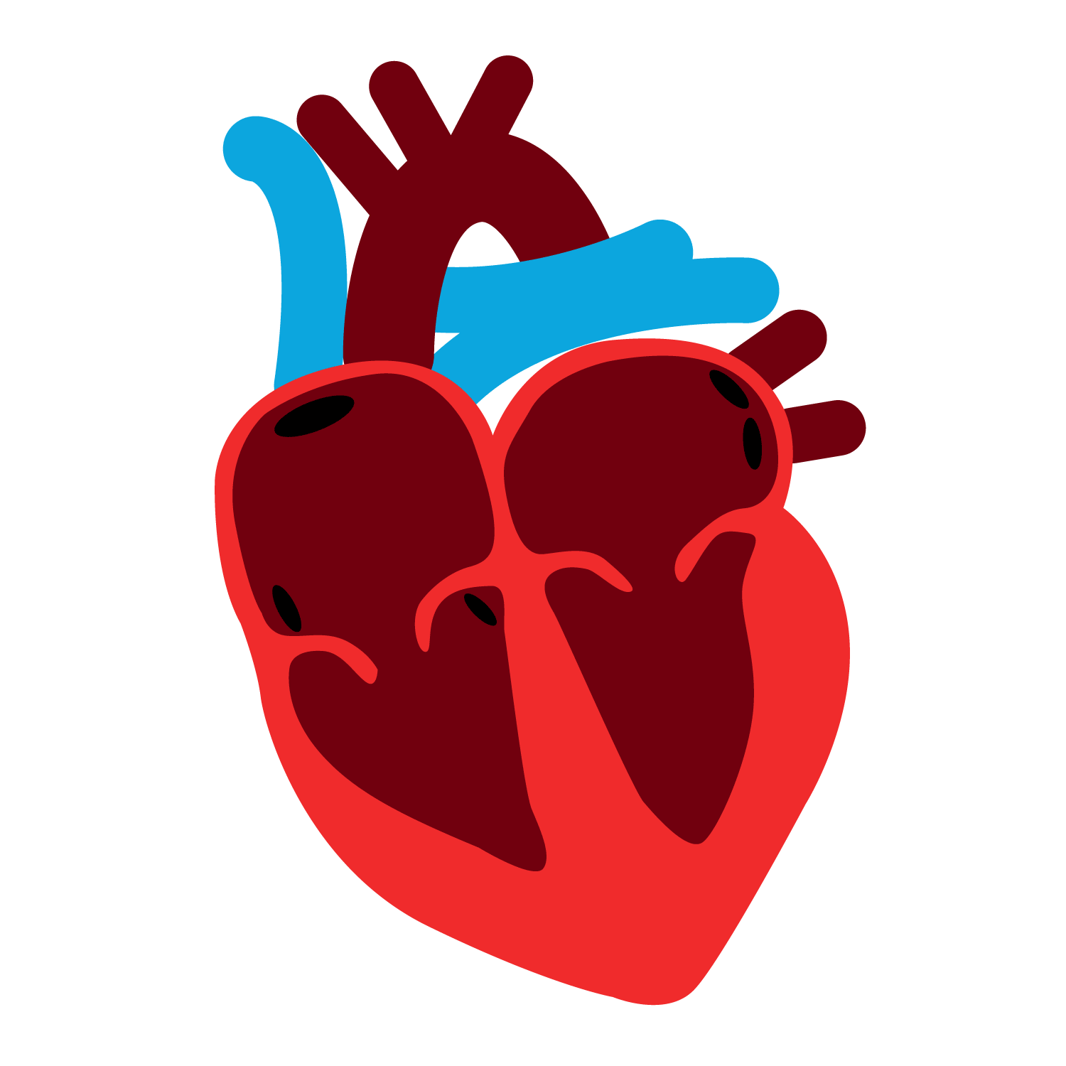 Heart Failure Alleviant Medical Lifting The Burden Of Heart Failure Heart Failure Alleviant Medical Lifting The Burden Of Heart Failure