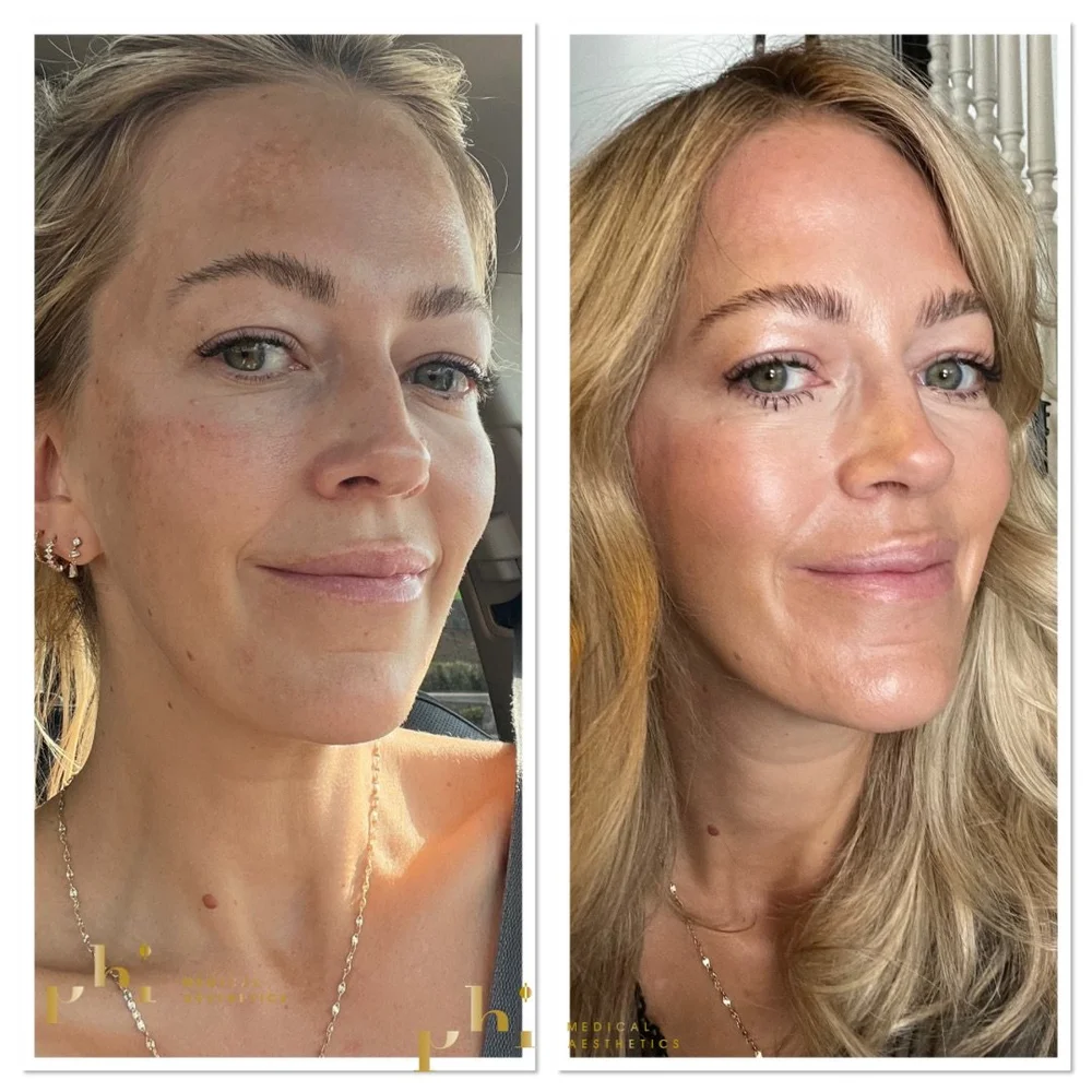 About PHI Medical Aesthetics — PHI Medical Aesthetics